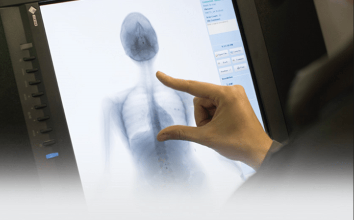 ODSecurity Announce New Contract of SOTER Body Scanner to Chilean ...